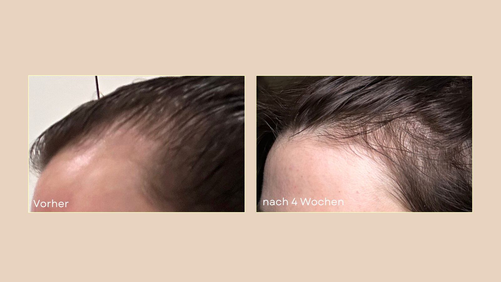 Haarwachstum pro Monat steigern – mit Serum & Kapseln von Tru Cosmetics